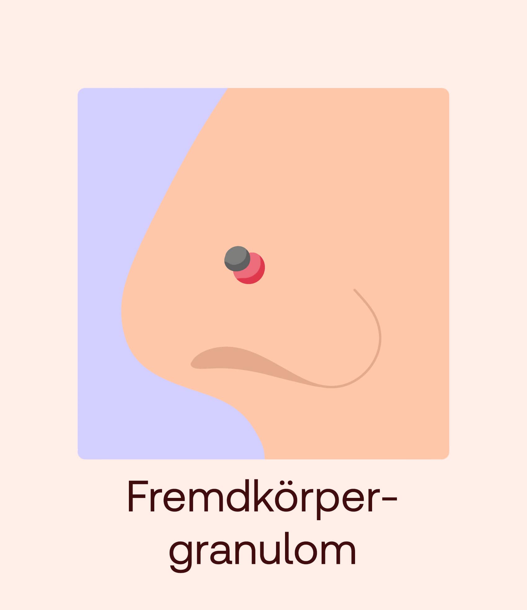 Granulom - Ursachen & Behandlung | Shop Apotheke